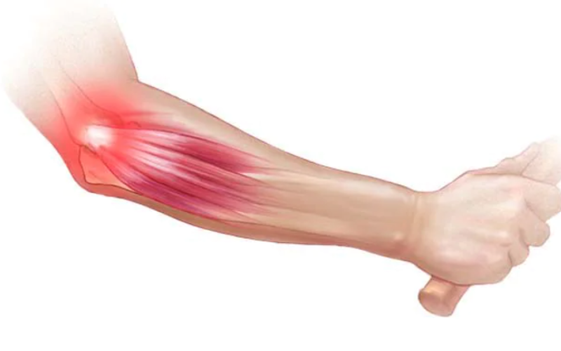 Tennis Elbow & Arm-Safety Checker